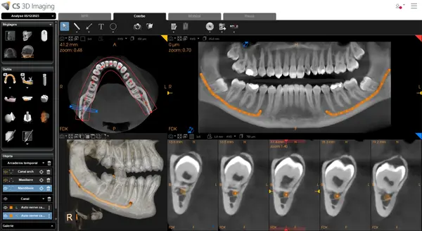 Carestream (CS) Imaging Suite 1.19.0 - Damas Wiki
