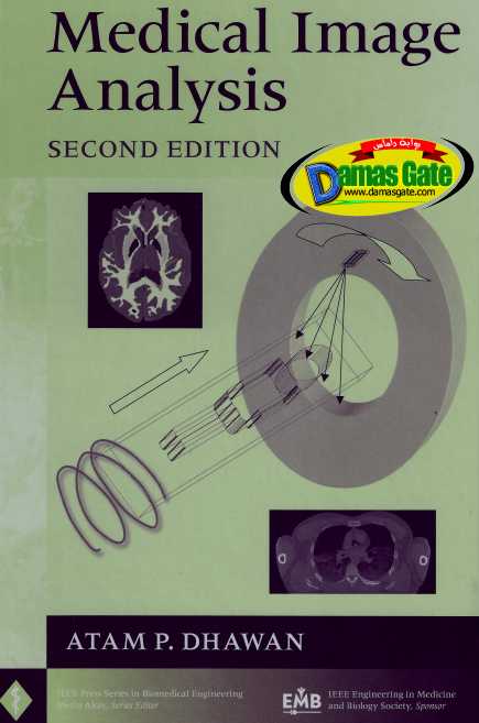 Medical Image Analysis - IEEE Biomedical Engineering Second Edition ...